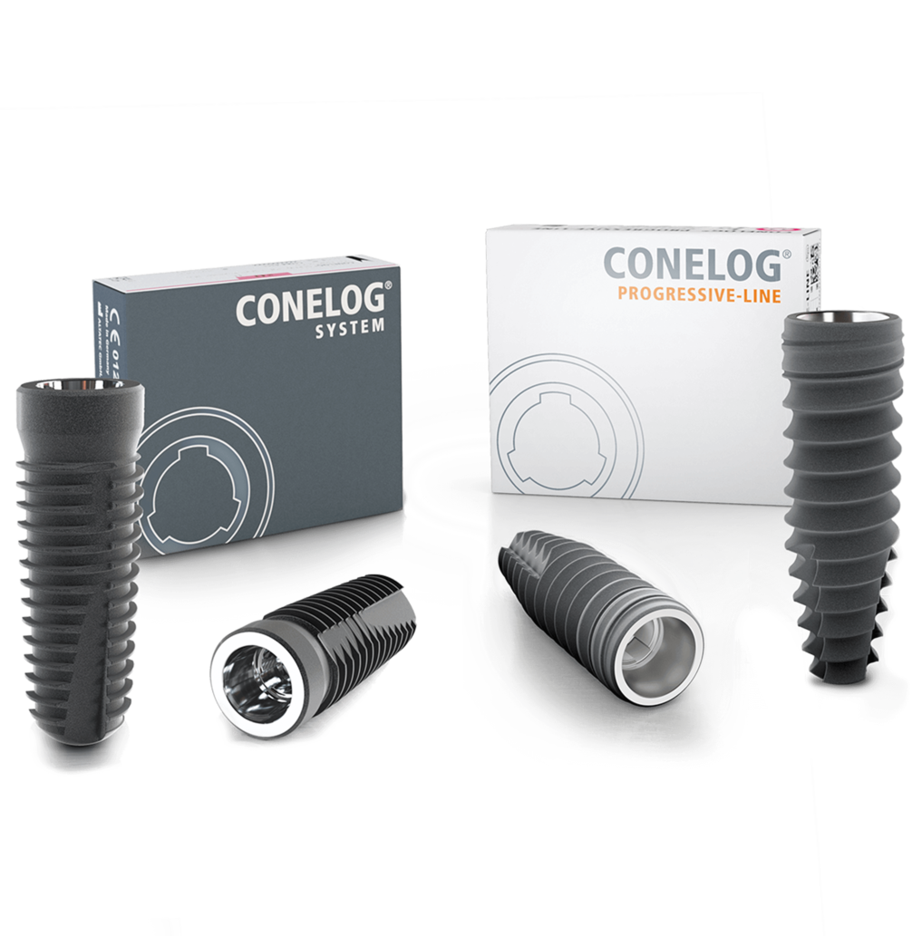 Camlog – Implantatsysteme für die dentale Implantologie