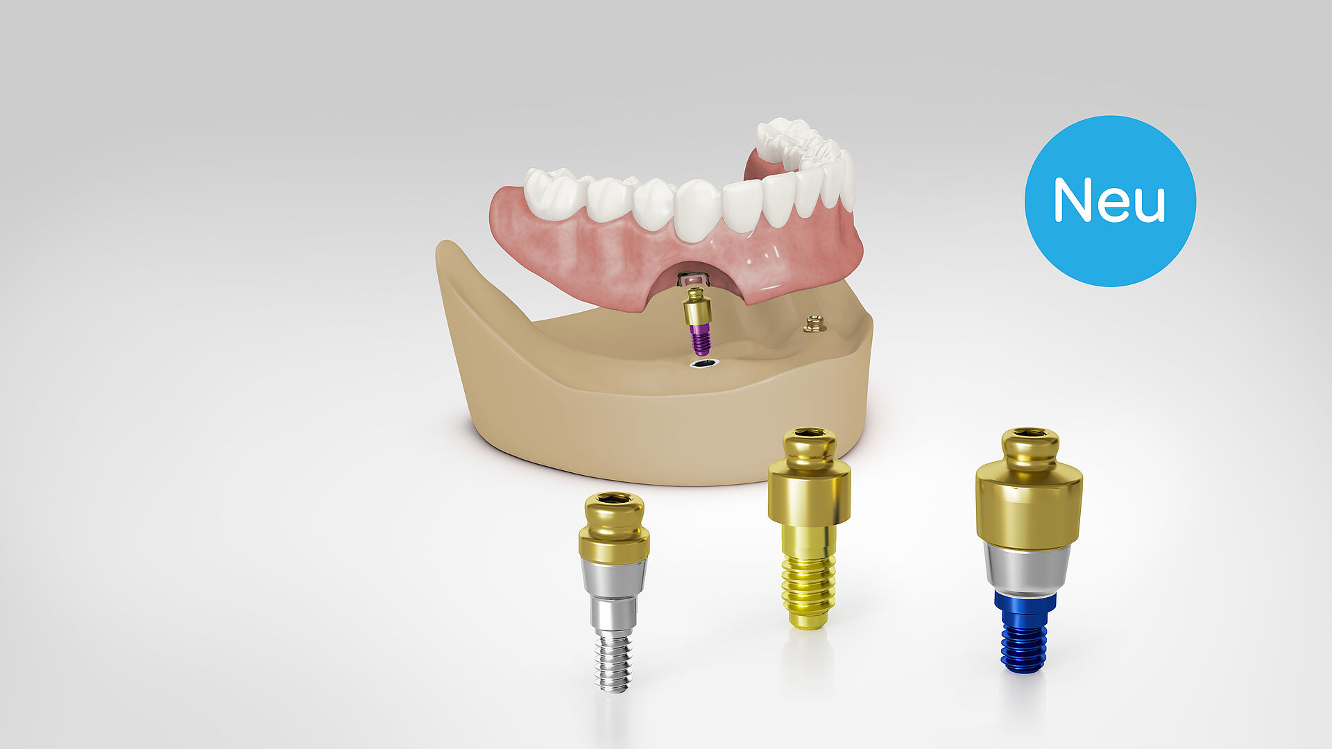 Camlog – Implantatsysteme für die dentale Implantologie