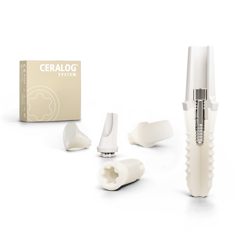 Camlog – Implantatsysteme für die dentale Implantologie