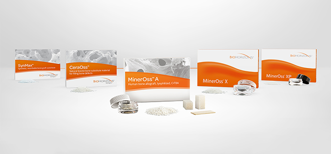 CERALOG® PROGRESSIVE-LINE