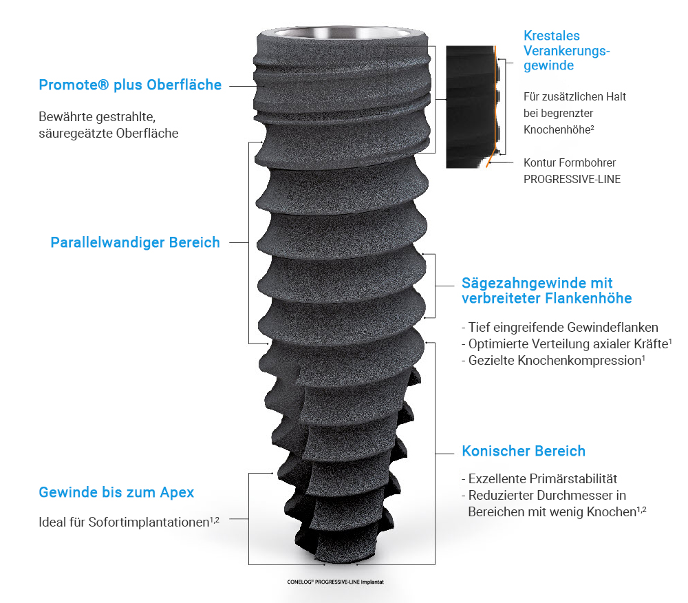 PROGRESSIVE-LINE Implantate von Camlog
